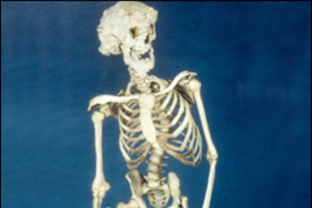 10 Sad Facts About "The Elephant Man" Joseph Merrick - Toptenz.net